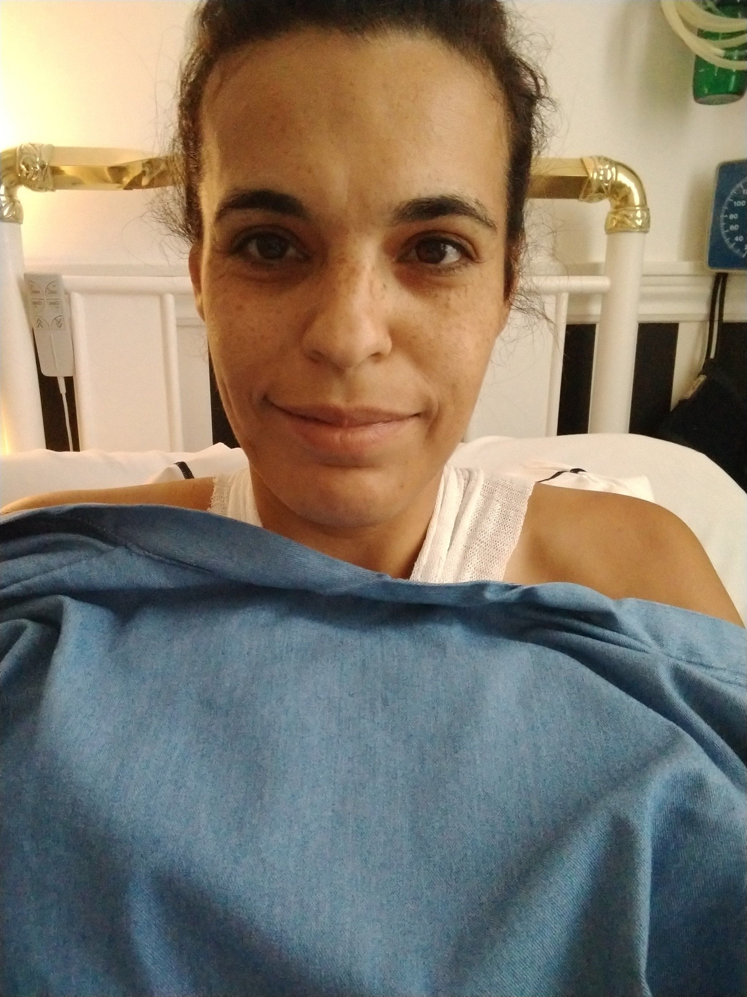 Operación realizada! Súper feliz - Aumento mamas - Esteticas.com.ar